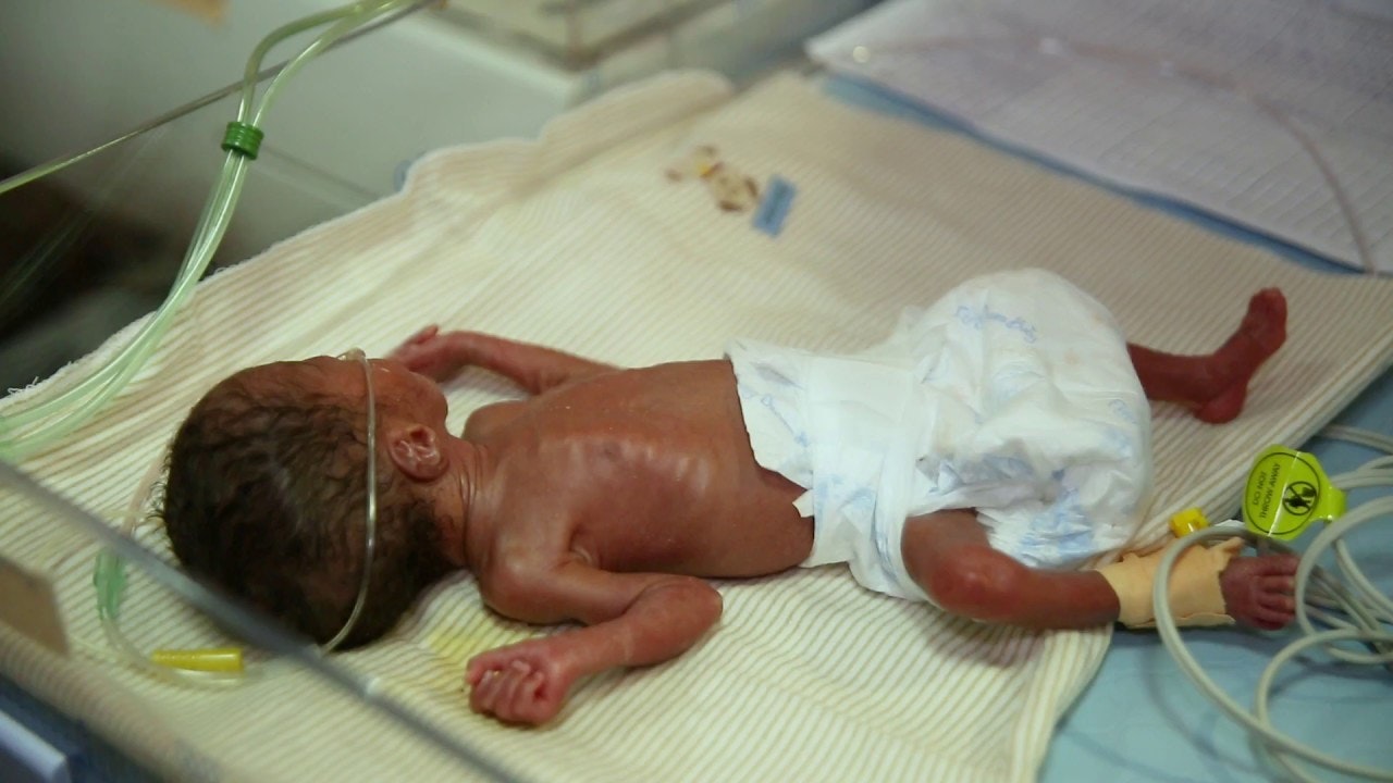 Diamedica Baby CPAP | Diamedica